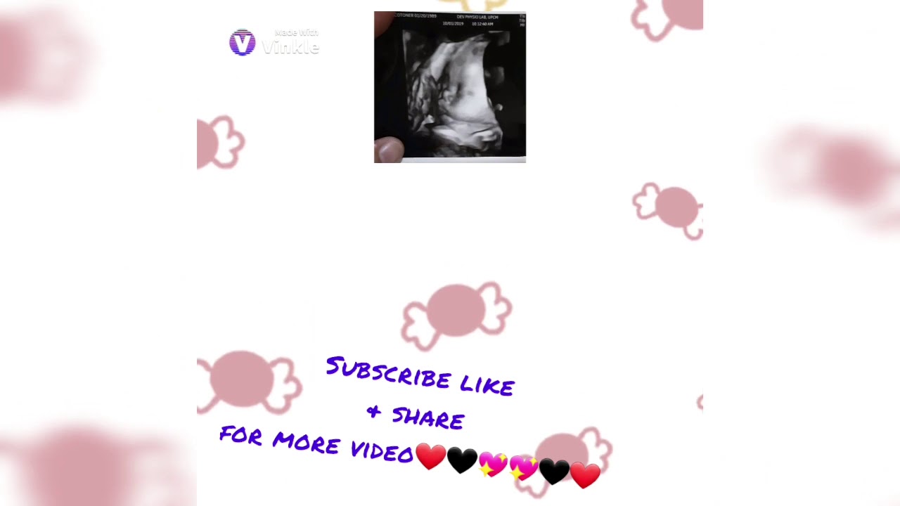 Thank you vinkle thx for wacthing(shane & sheryl vlogz) - YouTube