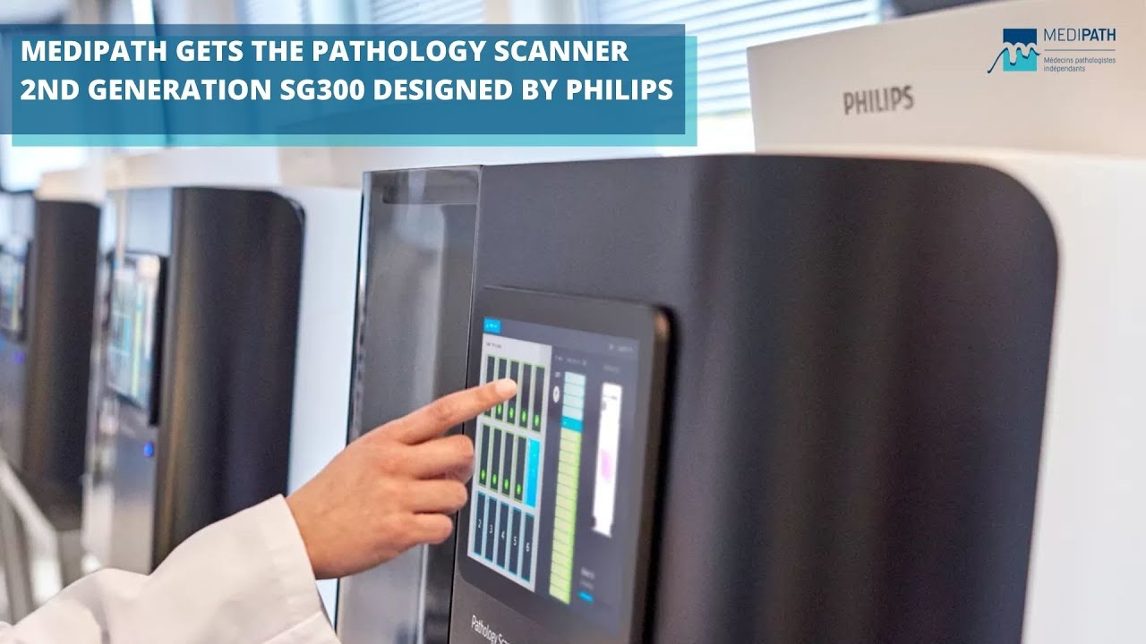 Discover the brand new Philips Scan SG300 - YouTube
