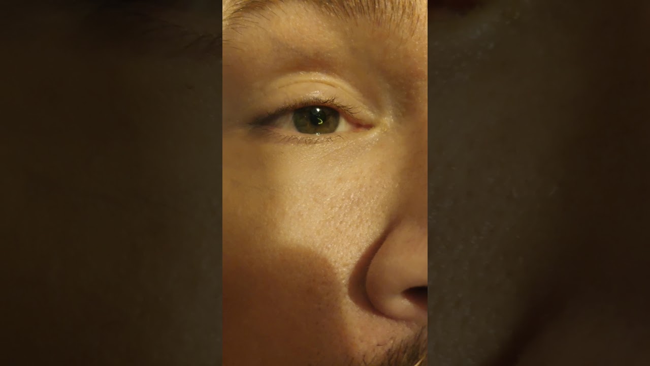 Alcon Clareon IOL Movement - YouTube