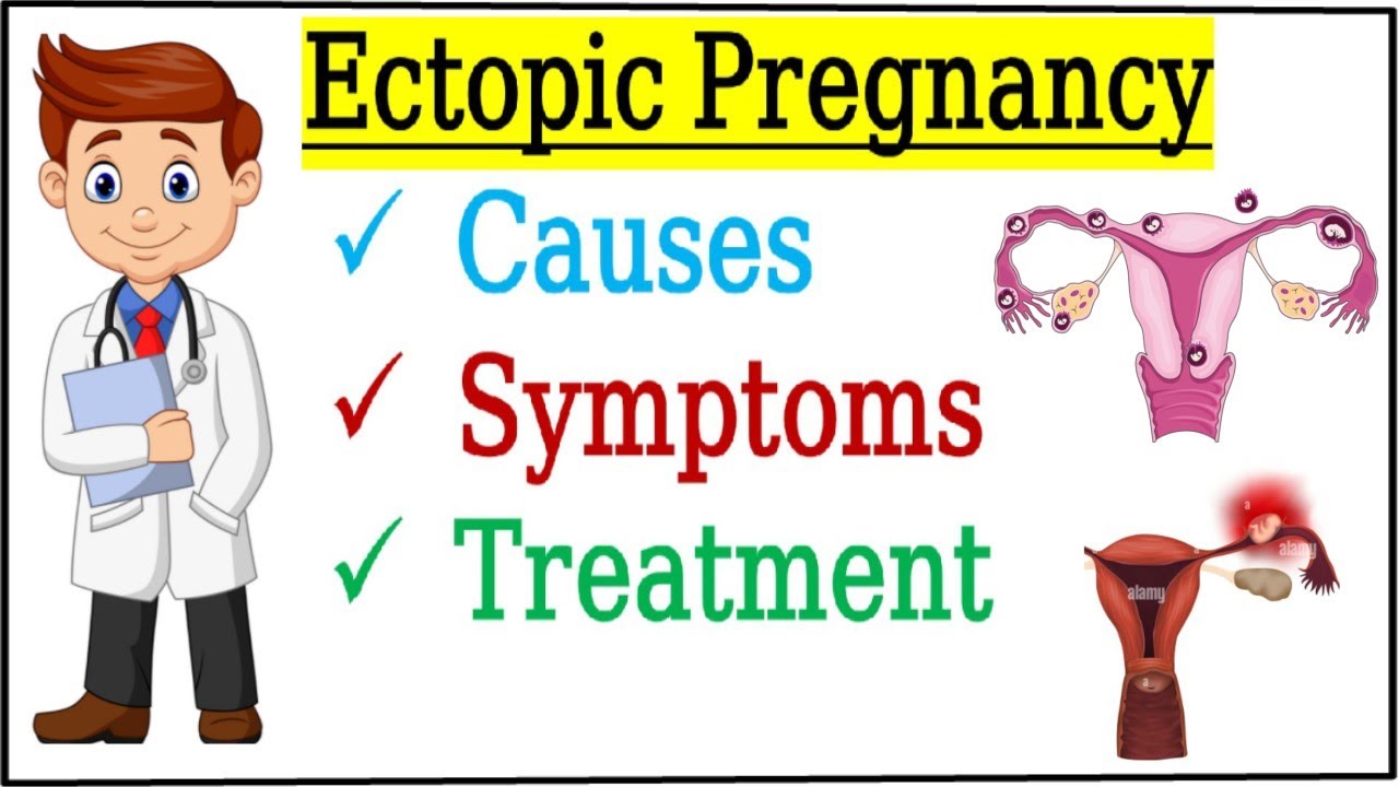 Ectopic Pregnancy | How to Diagnosis | Causes, Symptoms, Treatment of ...