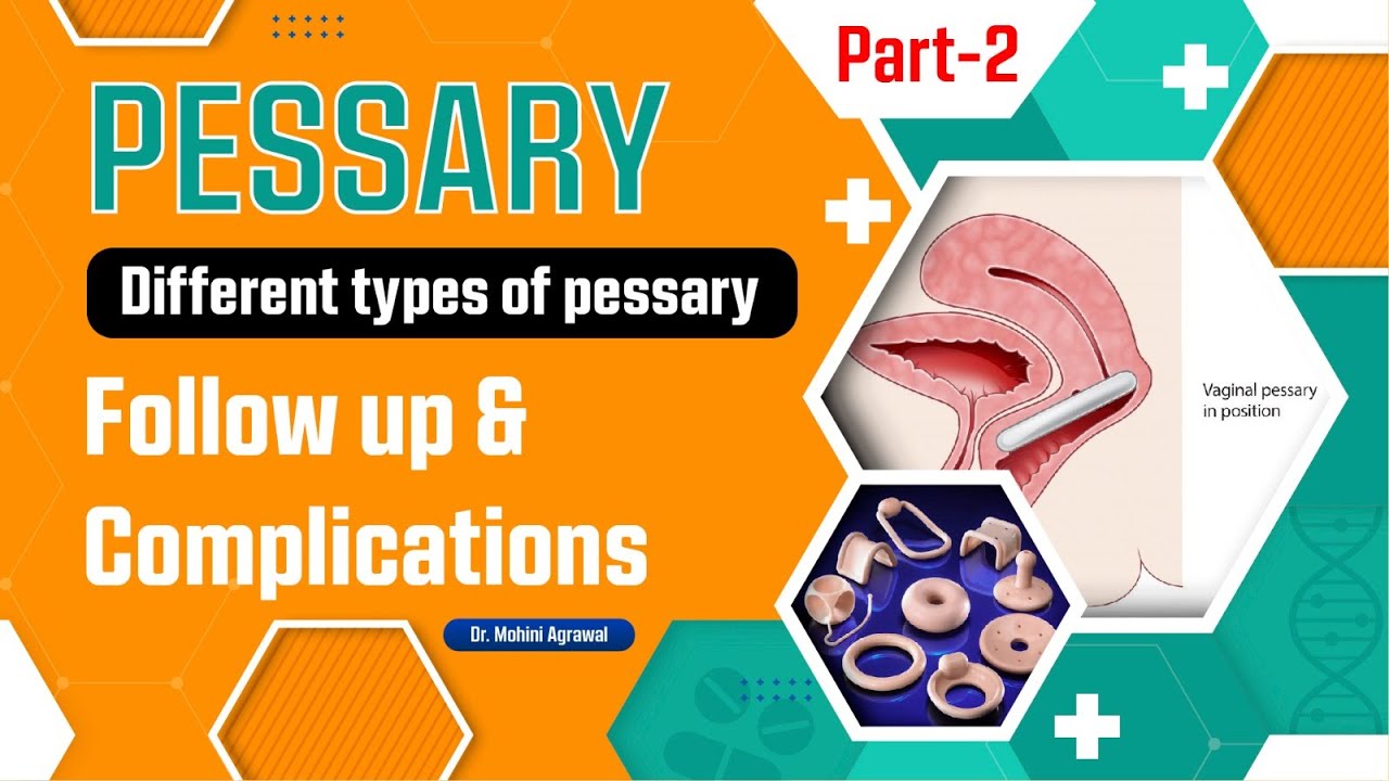 Pessary Types, Follow-up Care & Complications | Dr. Mohini Agarwal (EX ...