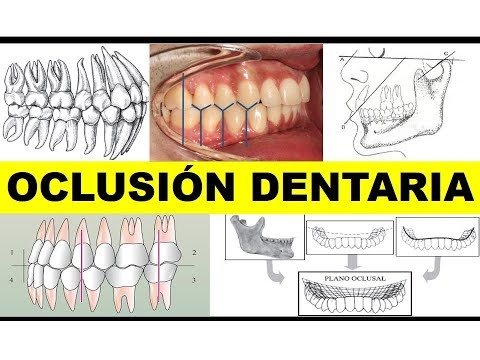 Fundamentos Básicos de Oclusión por el Dr. Hugo Perez - YouTube