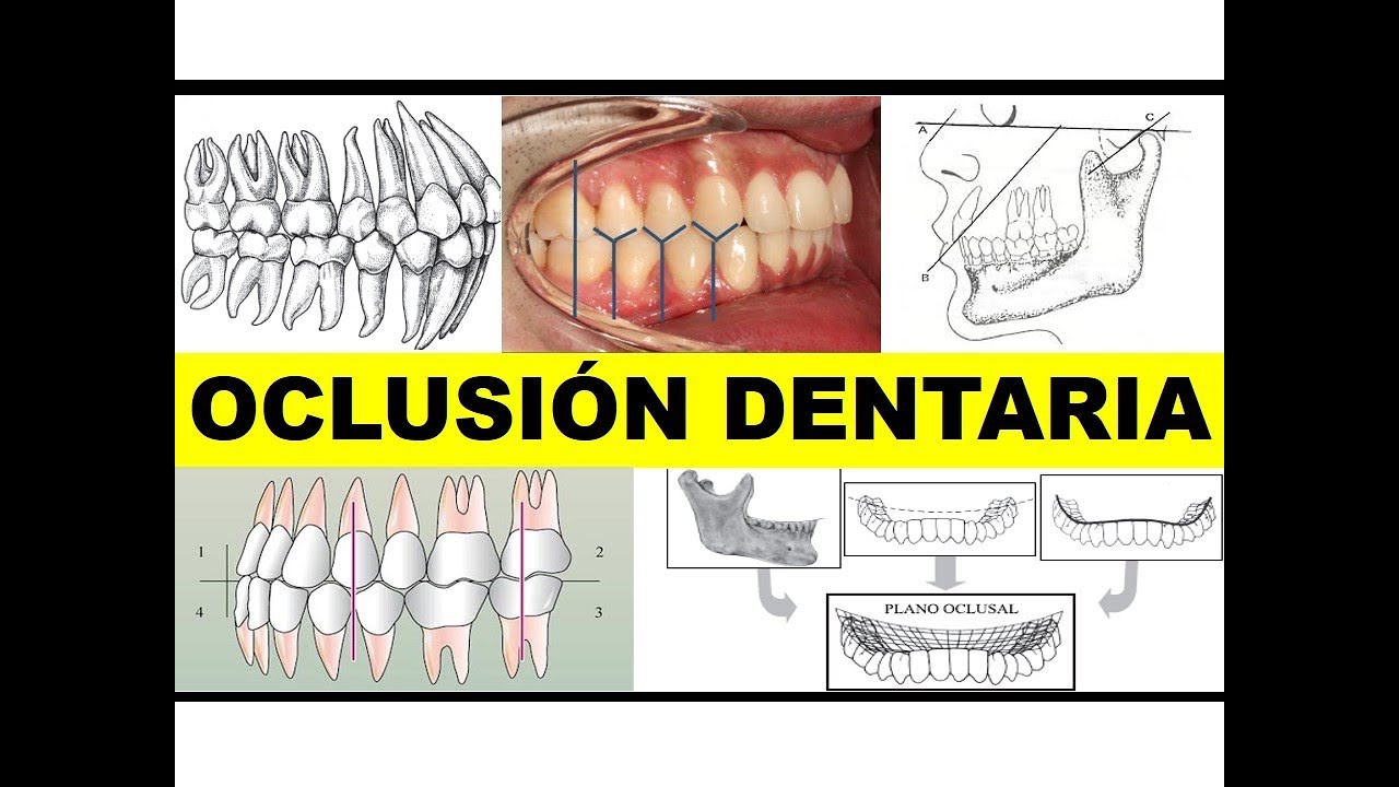 "OCLUSIÓN DENTARIA" por el Dr. Hugo Perez - YouTube