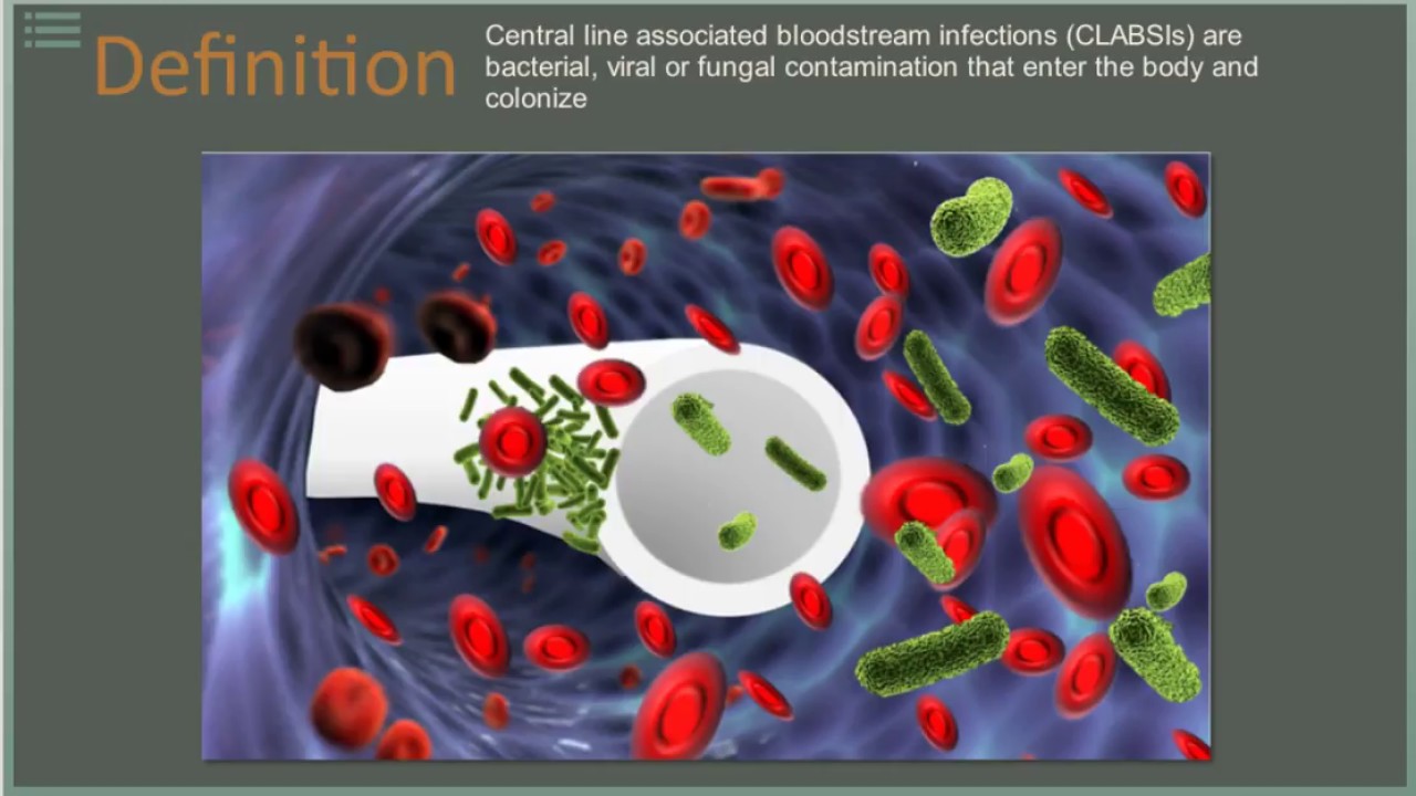 Infection Prevention of CVADs - YouTube