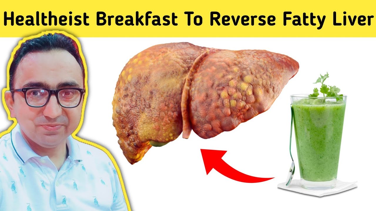 3 Healthiest Breakfast To Reverse Fatty Liver Disease - YouTube
