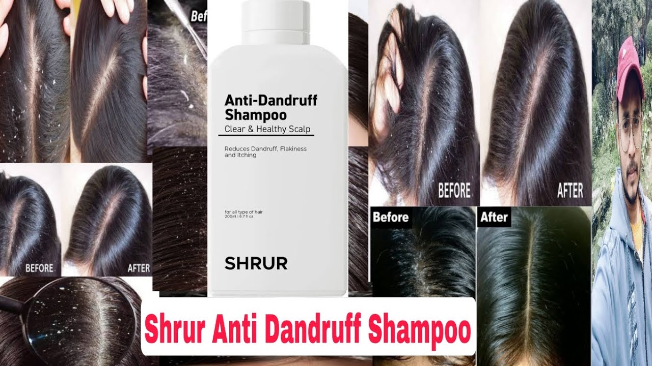 Shrur Anti Dandruff Shampoo Review - YouTube