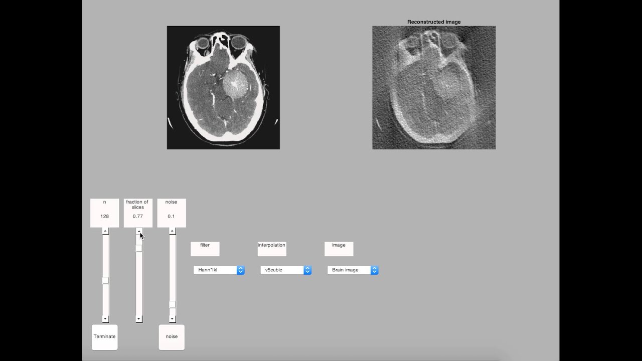 Filtered back projection (X-ray CT) Hann, with noise. - YouTube