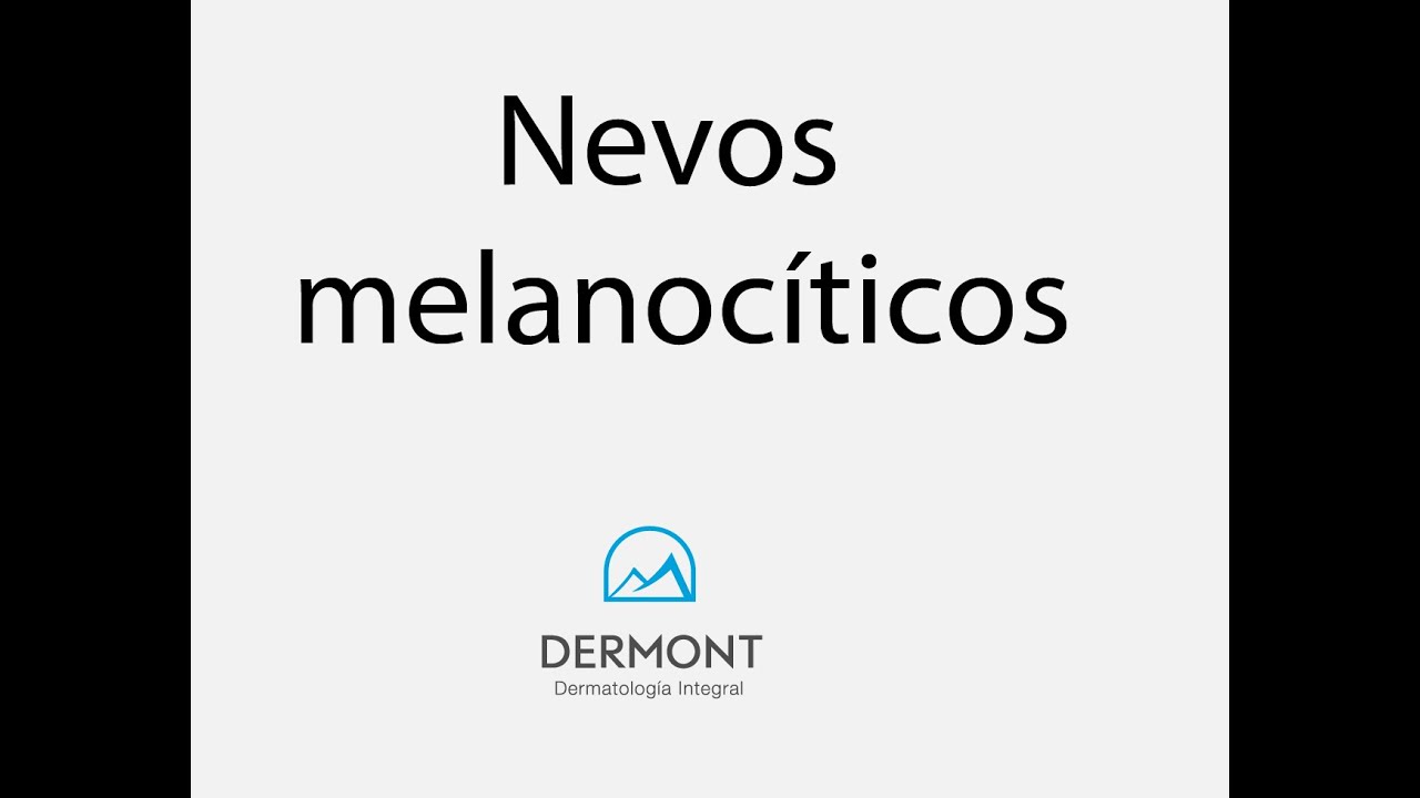 Nevos melanocíticos - YouTube