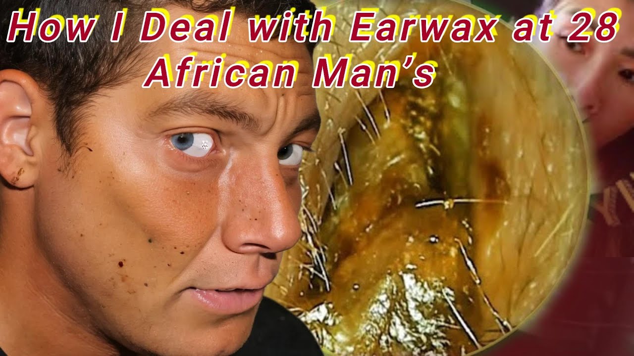 Ear Wax Removal Gone Wild! 😱 | Satisfying & Gross (But You Can’t Look ...