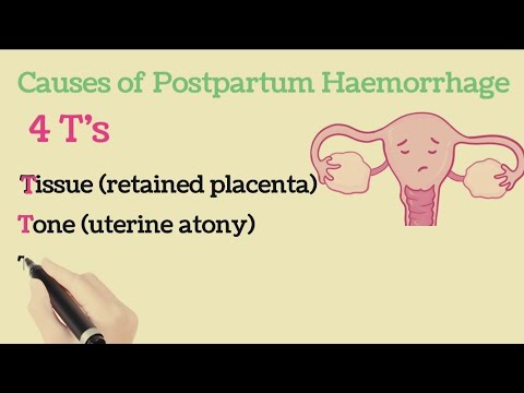 Causes Of Postpartum Haemorrhage (PPH) - YouTube