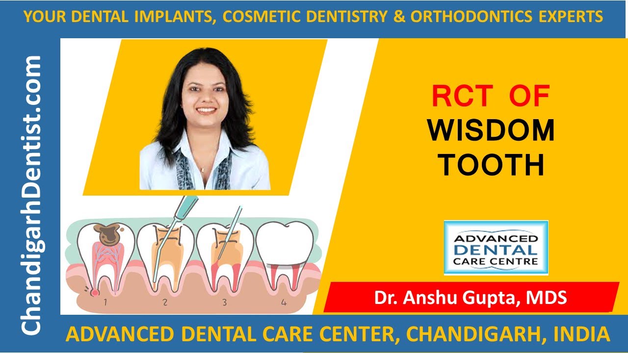 IS RCT OF WISDOM TOOTH POSSIBLE | BEST ROOT CANAL DENTIST MOHALI ...