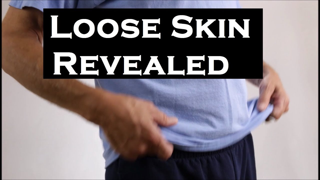 Butter Bob Reveals Loose Skin - YouTube