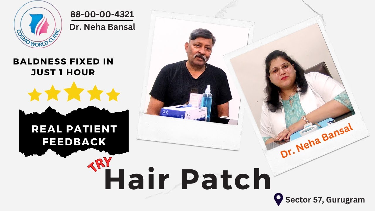 Hair Patch | Baldness| Real Patient Feedback - YouTube