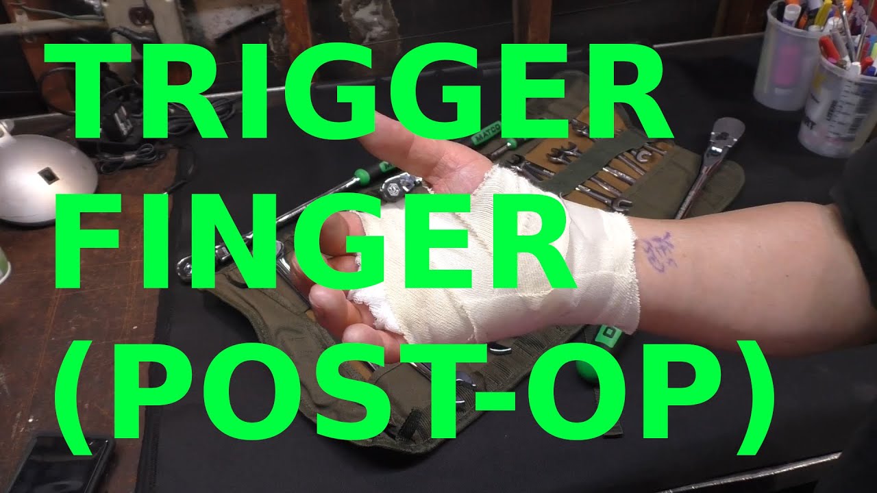 Trigger Finger (Post-Op) Update - YouTube