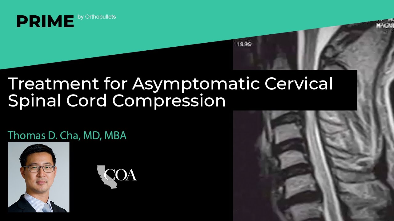 Treatment for Asymptomatic Cervical Spinal Cord Compression - Thomas D ...