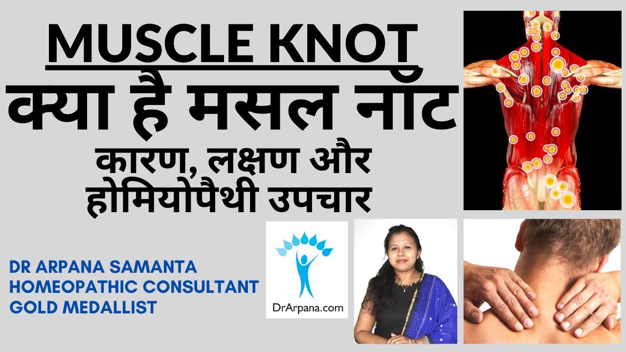 क्या है मसल नॉट, कारण, लक्षण और होमियोपैथी उपचार | Muscle Knots ...