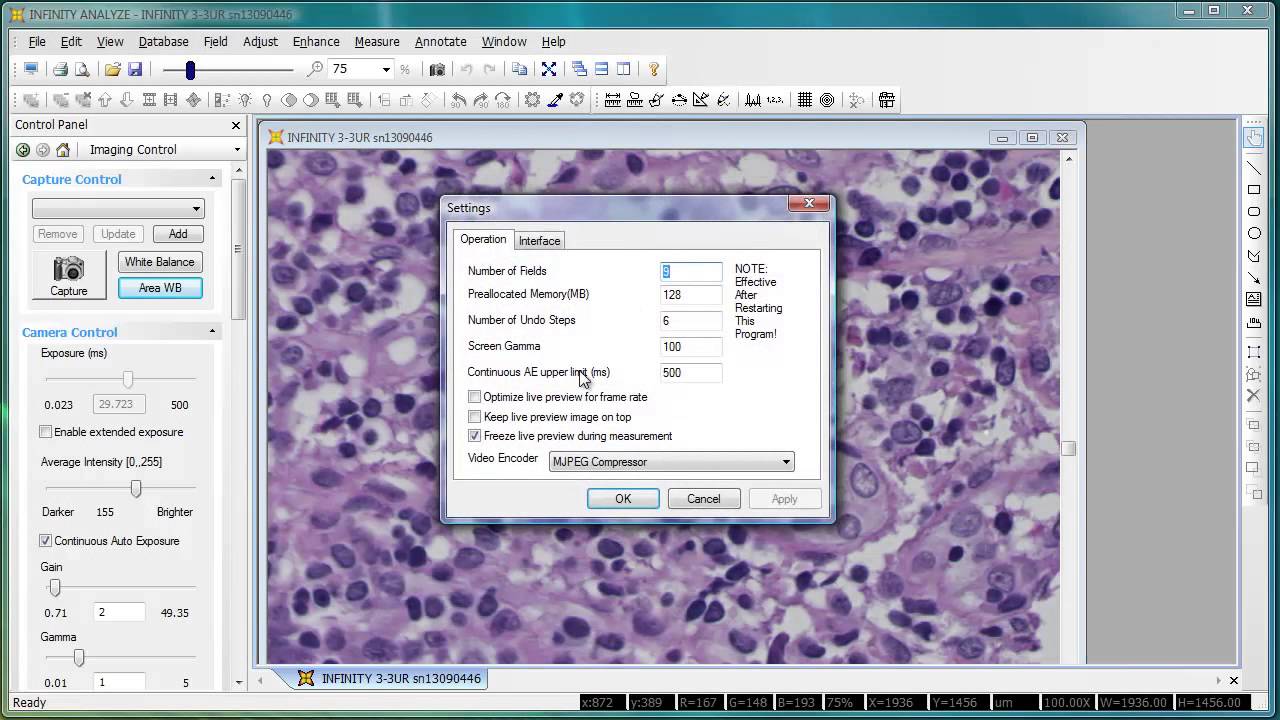 INFINITY ANALYZE SOFTWARE: Auto Exposure Upper Limit - YouTube