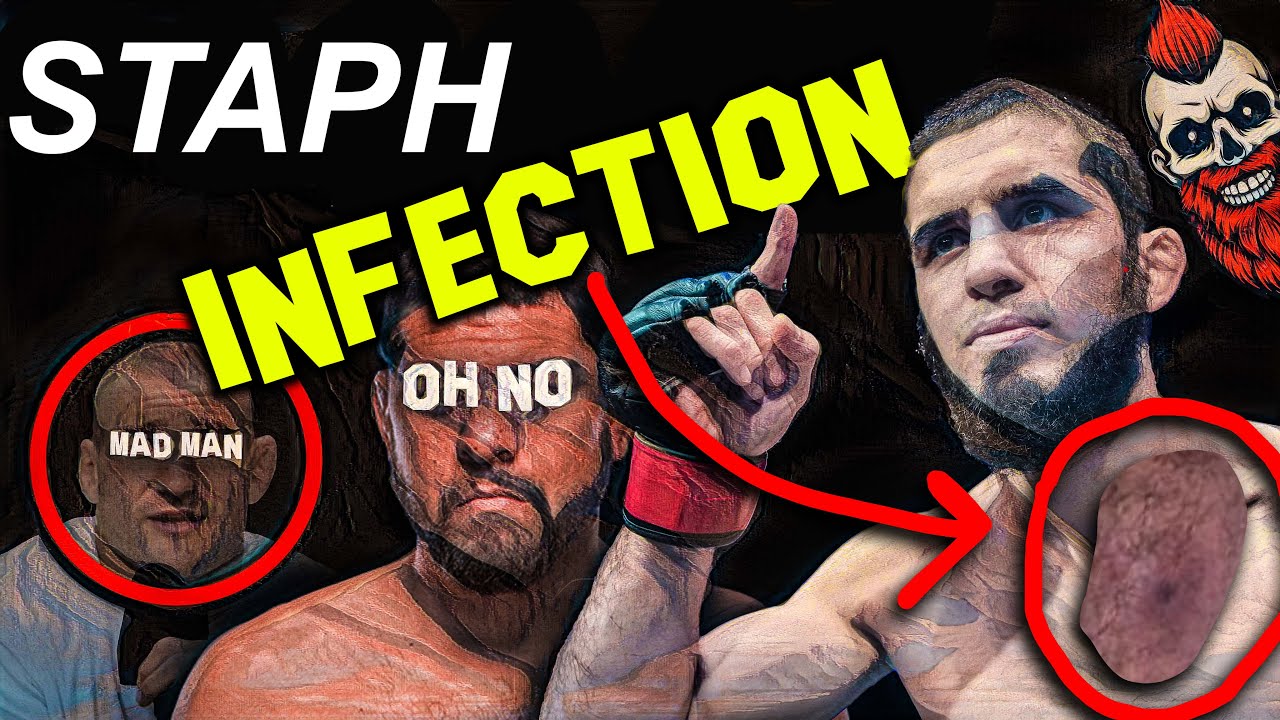 STAPH INFECTION on Islam Makhachev + Nick Diaz RETURNS + Sean ...