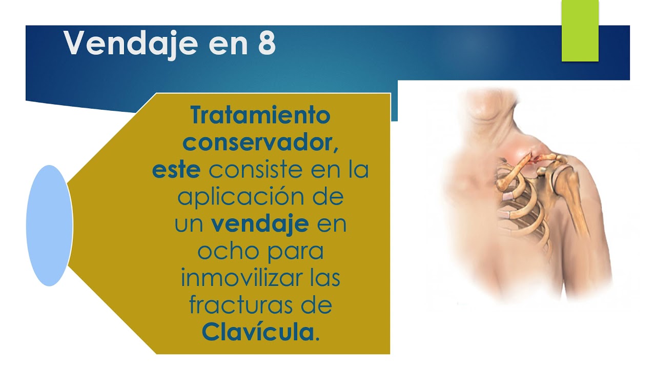 4. Cuidados del Yeso - YouTube