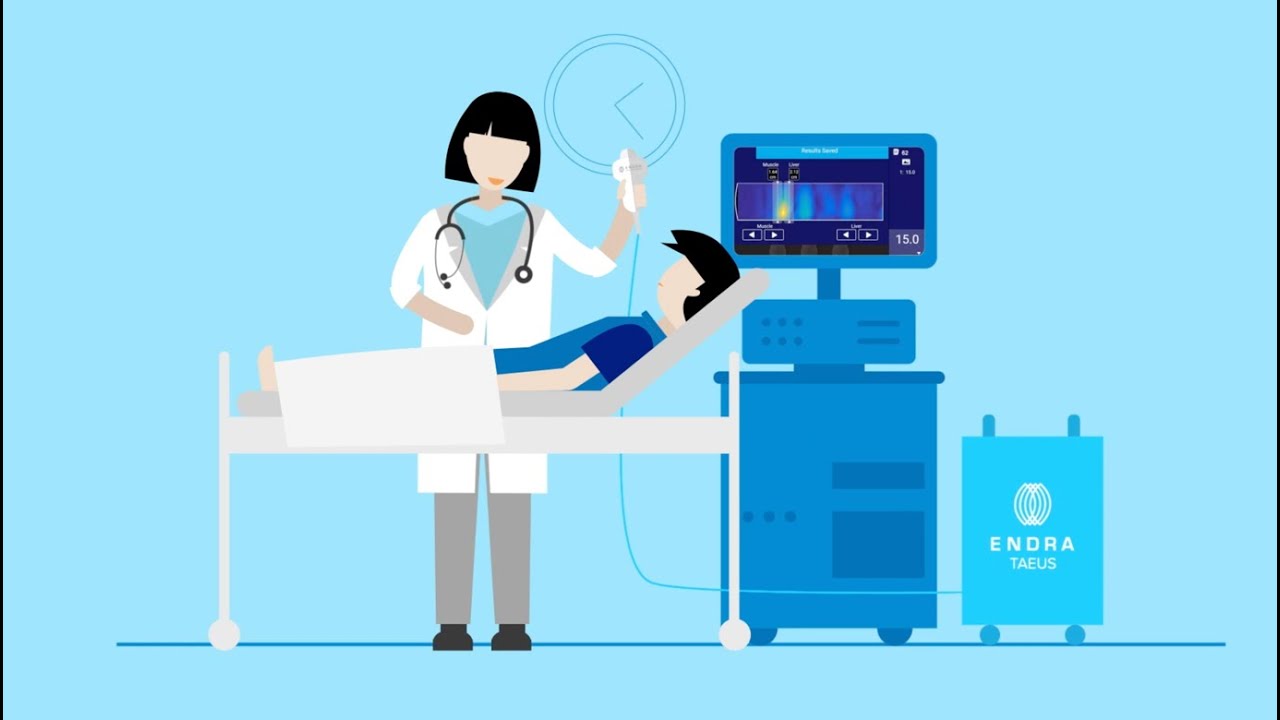 TAEUS®: Focused on early detection of liver disease - YouTube
