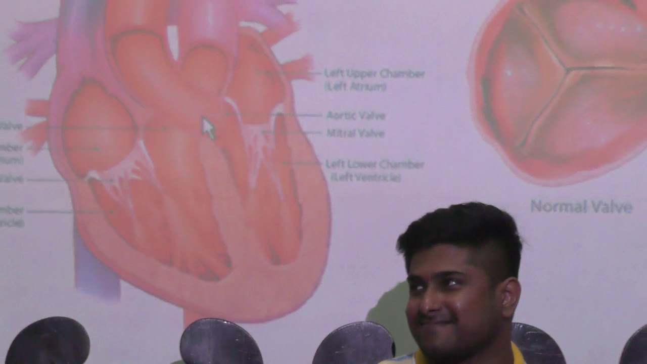 Dr Rajaram Anantharaman on India's First Transcatheter Heart Valve ...