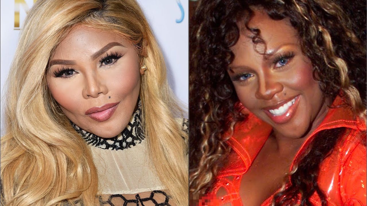 The Toxic Culture of Plastic Surgery in Hip Hop Reaction - YouTube