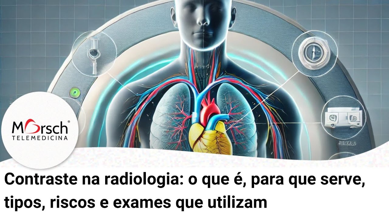 Contraste na radiologia o que é, para que serve, tipos, riscos e exames ...