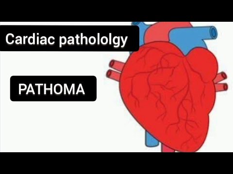 Cardiac Pathoma part 4| congenital heart defects 1| - YouTube