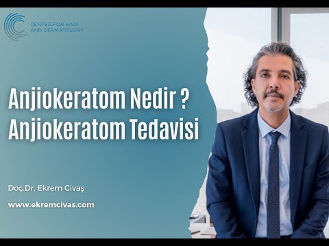 Anjiokeratom  Nedir  -  Anjiokeratom Tedavisi