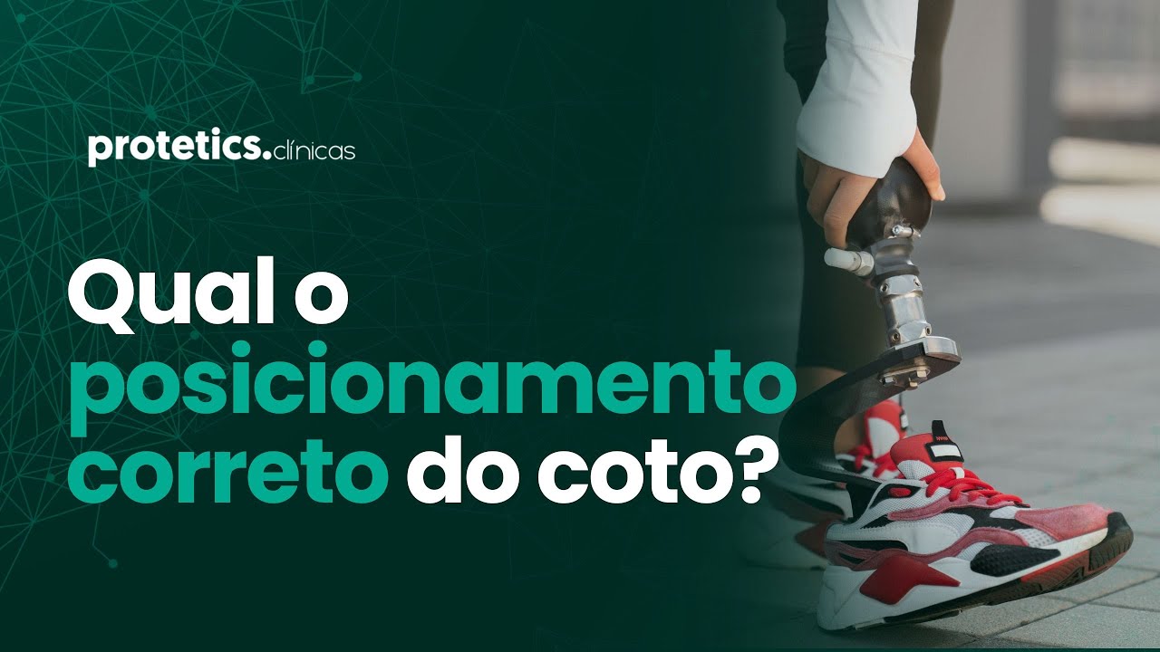 Como Posicionar o Coto Corretamente: Guia Prático para Usuários de ...
