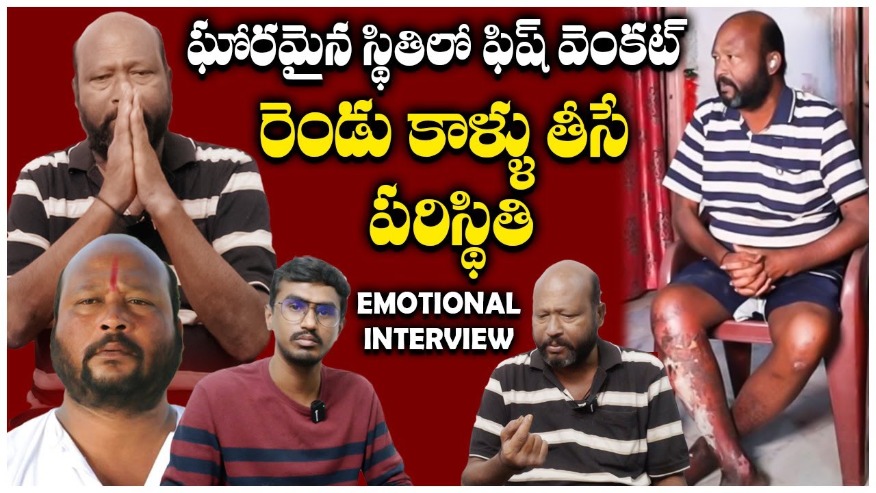 Actor Fish Venkat About His Health Condition | Fish Venkat Interview ...