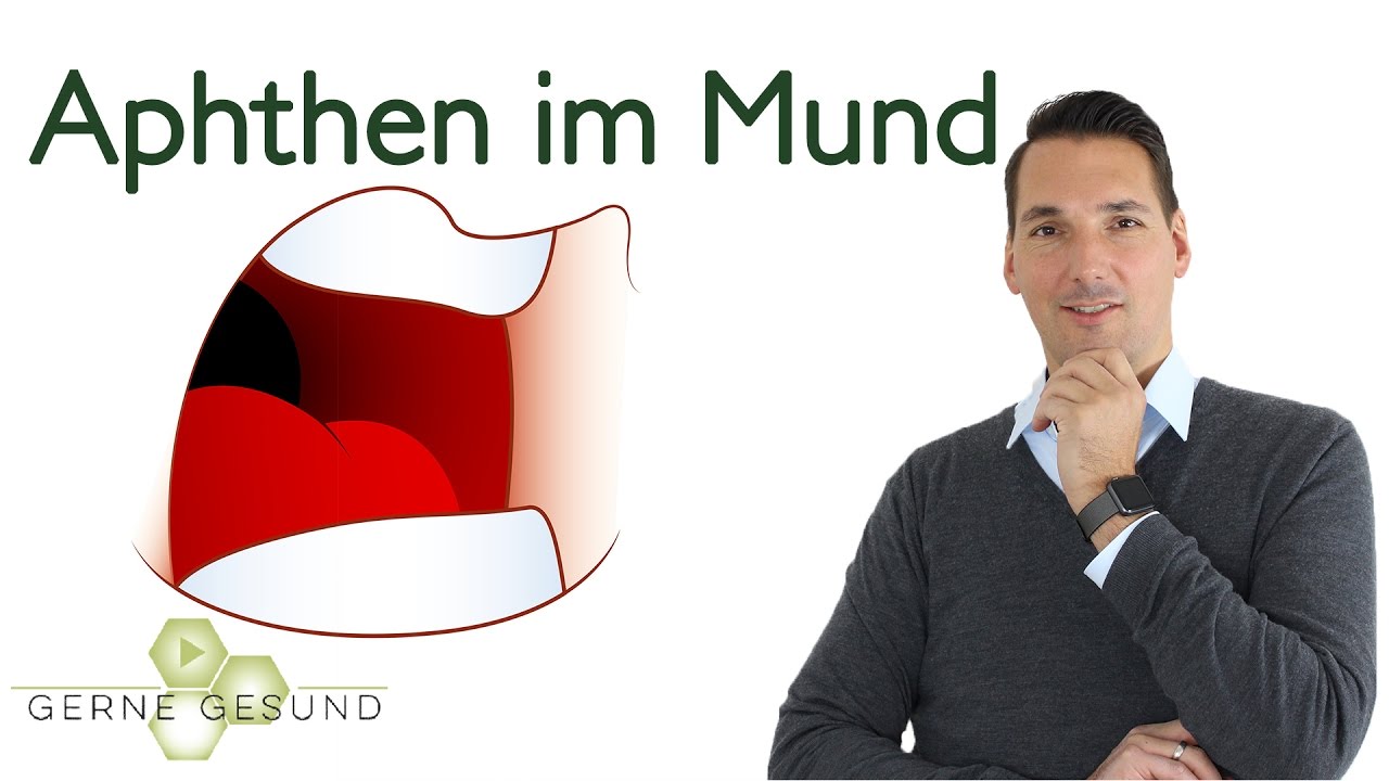 Was ist eine Aphthe und wie wird sie behandelt? - Gerne Gesund - YouTube
