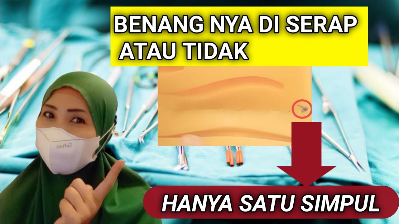 CARA TEKNIK HECTING SUBCUTIKULER SUTURE DENGAN SIMPUL DI LUAR - SIMPUL ...