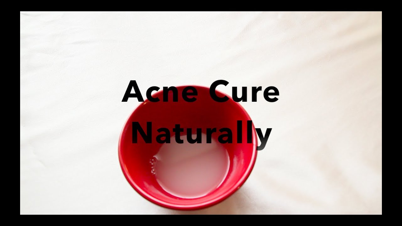 DIY: Acne Treatment | How to Get Rid of Acne Naturally ! ♥ - YouTube