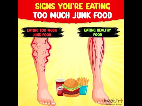 Signs You're Eating Too Much Junk Food - YouTube