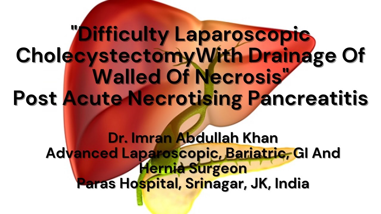 Difficult Laparoscopic Cholecystectomy With Drainage Of Walled Of ...