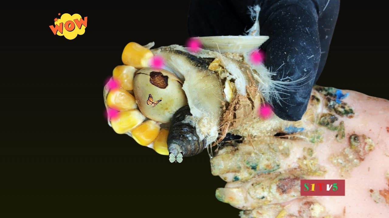 Trim ingrown toenails like horns😭 inverted toenails😭 toenail fungus d.r ...