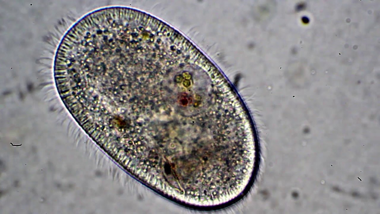 Ciliate Under The Microscope - Frontonia - YouTube