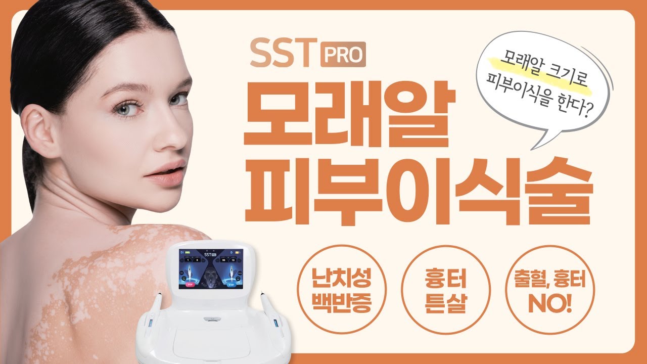 백반증 모래알피부이식술 SST PRO - YouTube