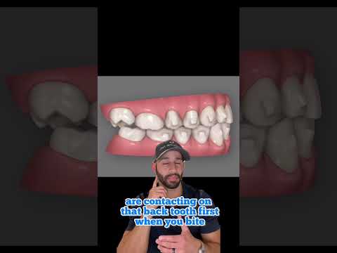 Would Invisalign Help With Grinding