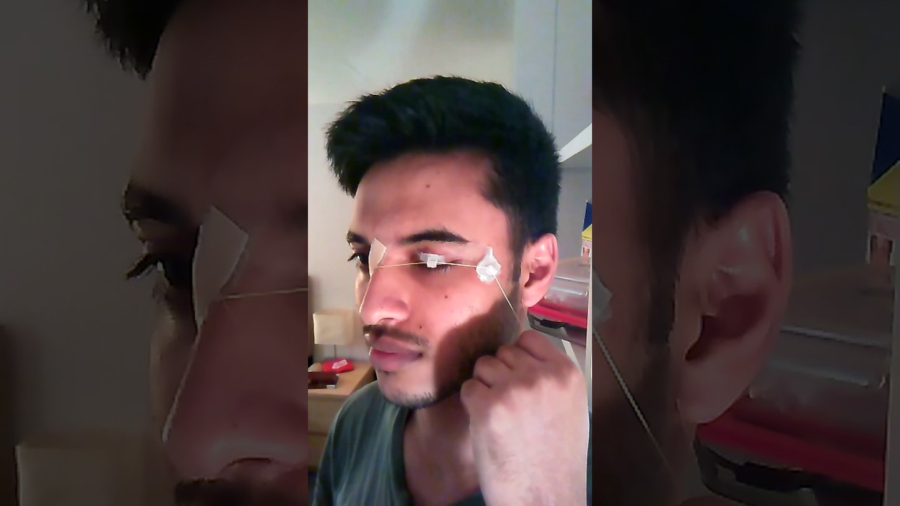 Artificial Eyelid Closure - Hand Pull - YouTube