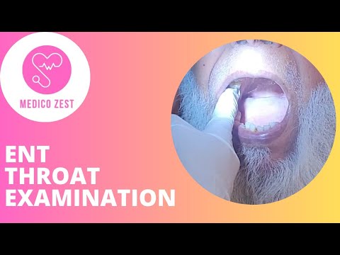 ENT examination part #3 | ENT throat examination - YouTube