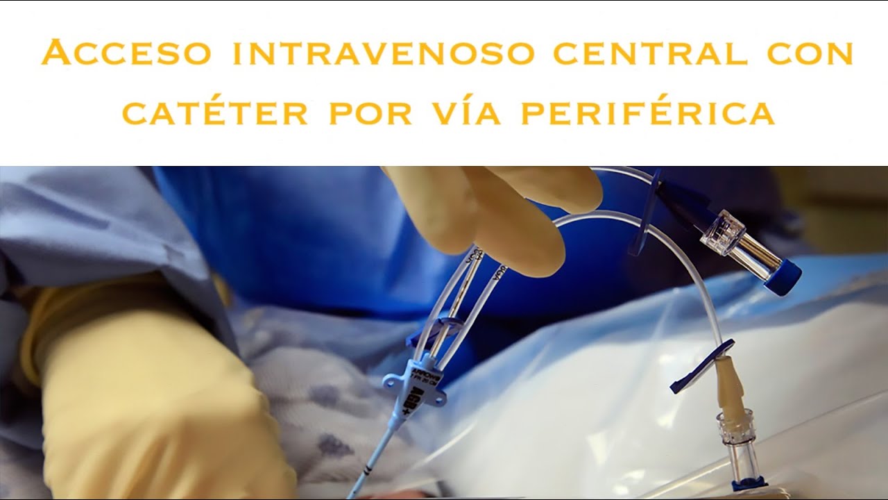ACCESO INTRAVENOSO CENTRAL CON CATÉTER POR VÍA PERIFÉRICA - YouTube