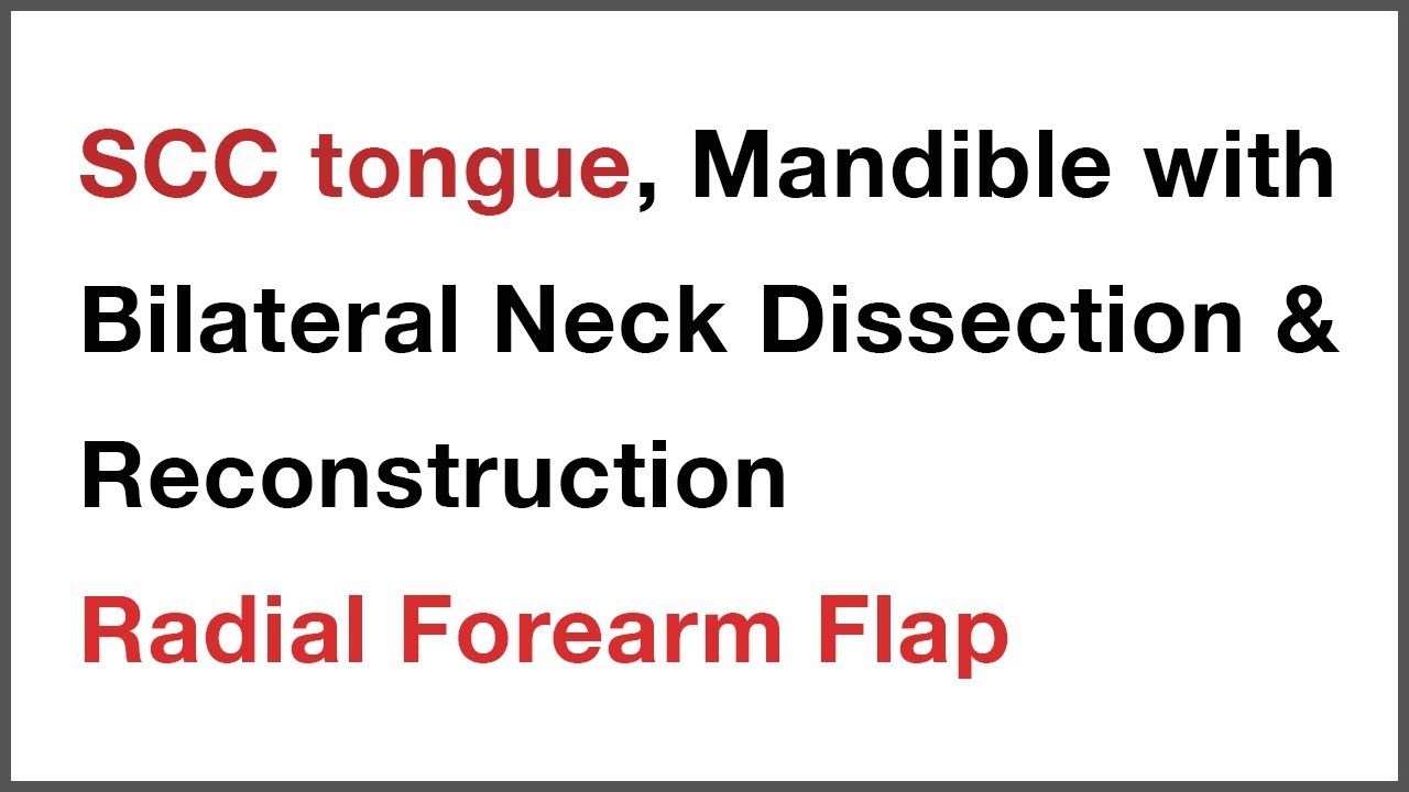 SCC tongue, Mandible with Bilateral Neck Dissection & Reconstruction ...