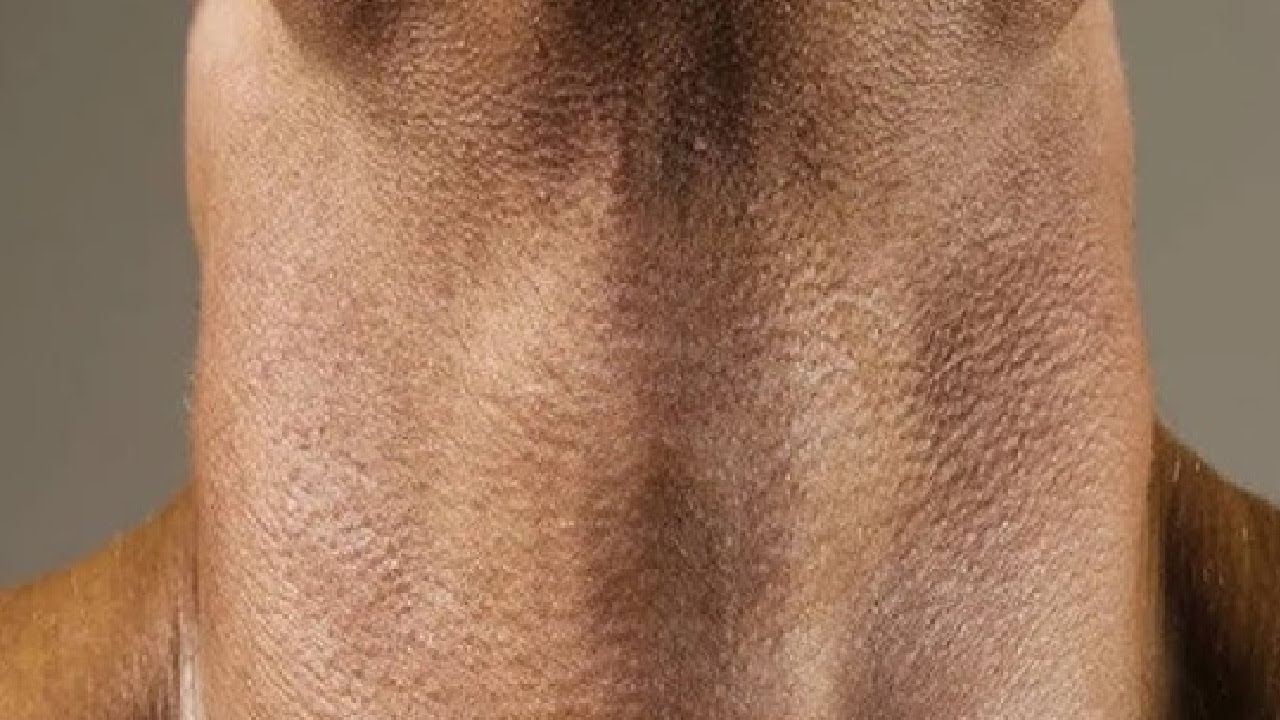 fastest way to get a thicker neck - YouTube