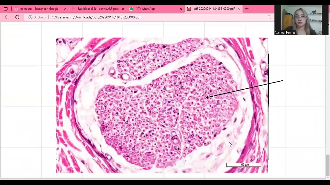 Nervios periféricos: estructura. Epineuro. Perineuro. Endoneuro - YouTube