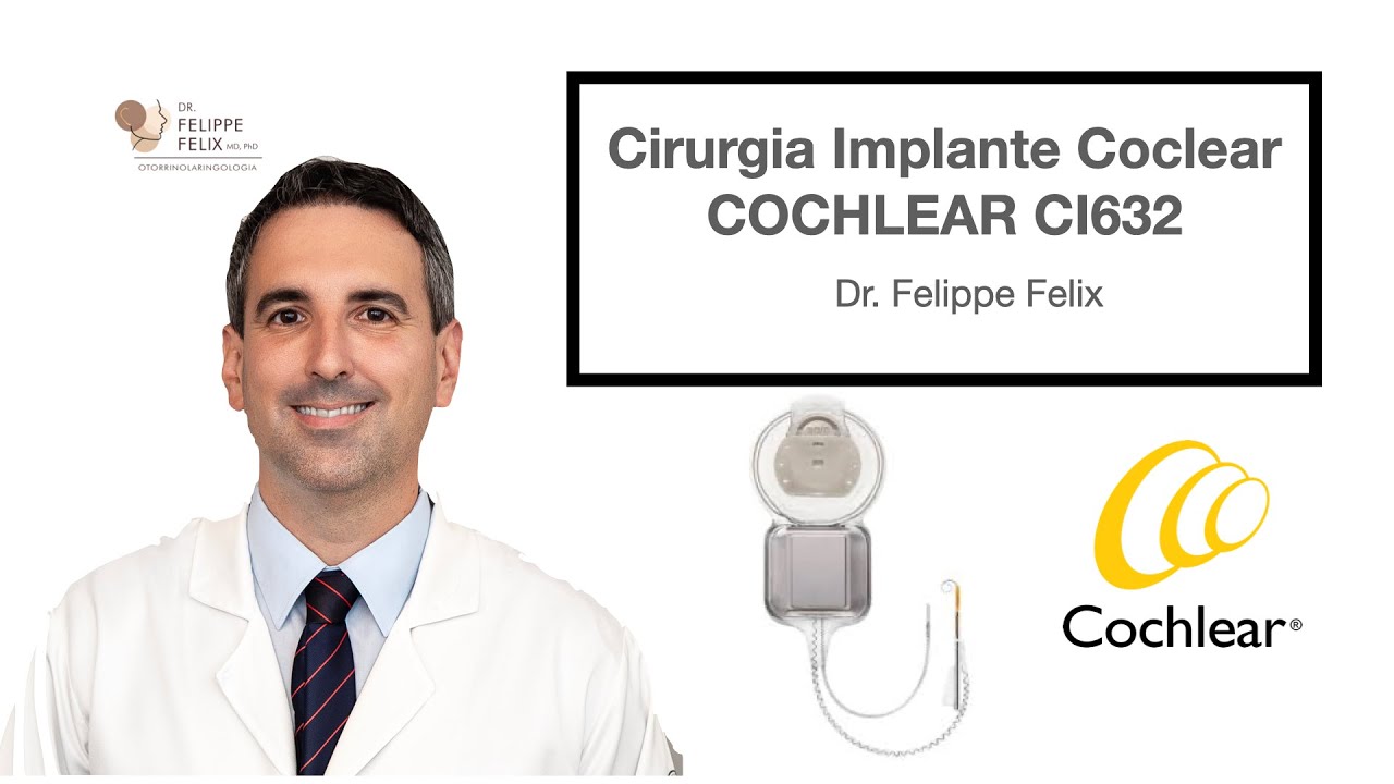 Cochlear Implant Surgery - electrode CI632 - Dr. Felippe Felix - YouTube