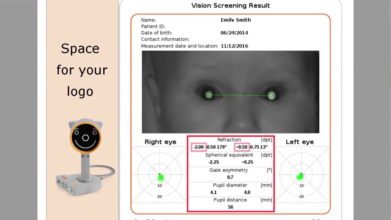 plusoptiX S16 - Documenting the Measurement Results - YouTube