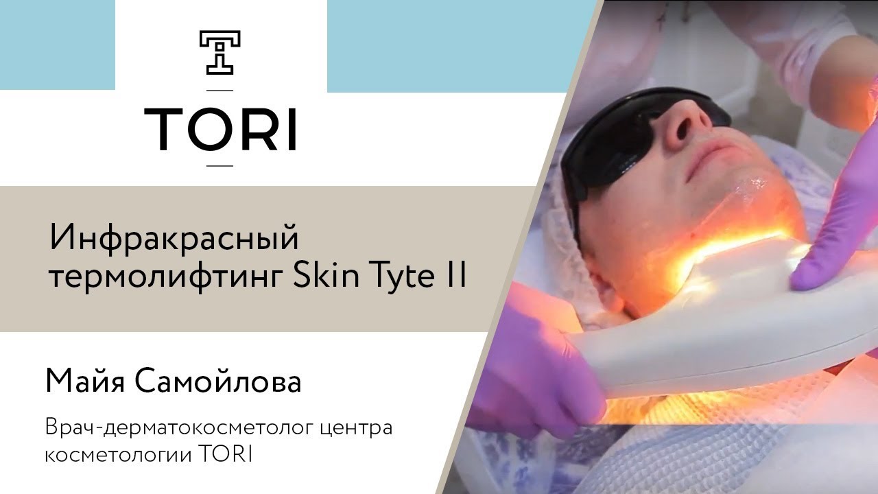 Инфракрасный термолифтинг Skin Tyte II - YouTube