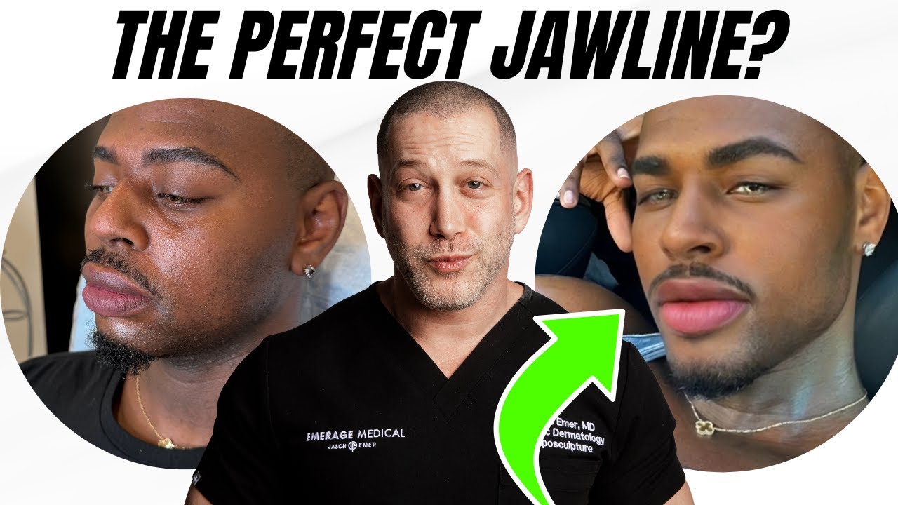 Male Model Facial Sculpting in Minutes | Dr. Jason Emer - YouTube